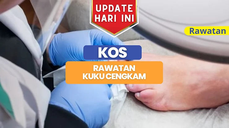 Kos Rawatan Kuku Cengkam di Malaysia Terkini 2026
