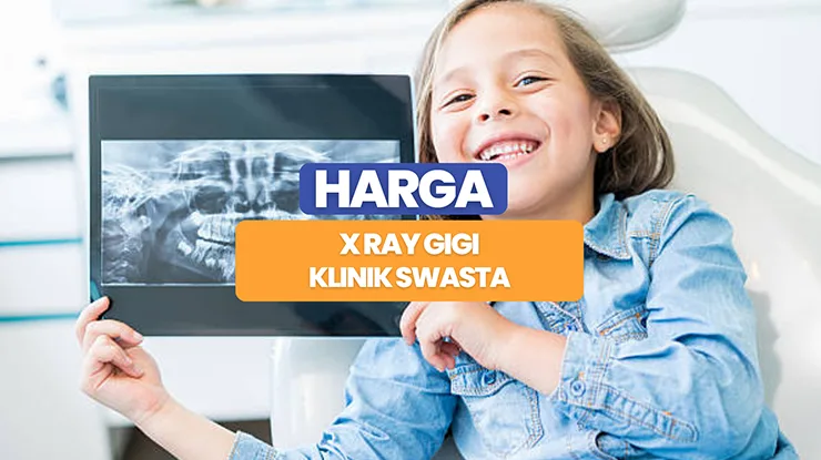 Harga X Ray Gigi Klinik Swasta Terkini 2026